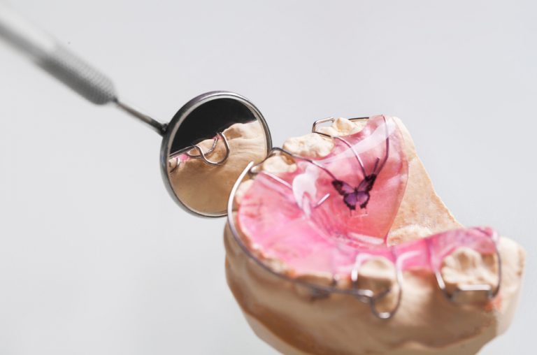 What is an Orthodontic Plate?